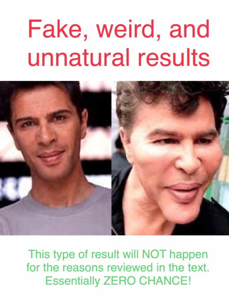 Fake, Weird, Bad, and Unnatural Results in Cosmetic and Plastic Surgery ...