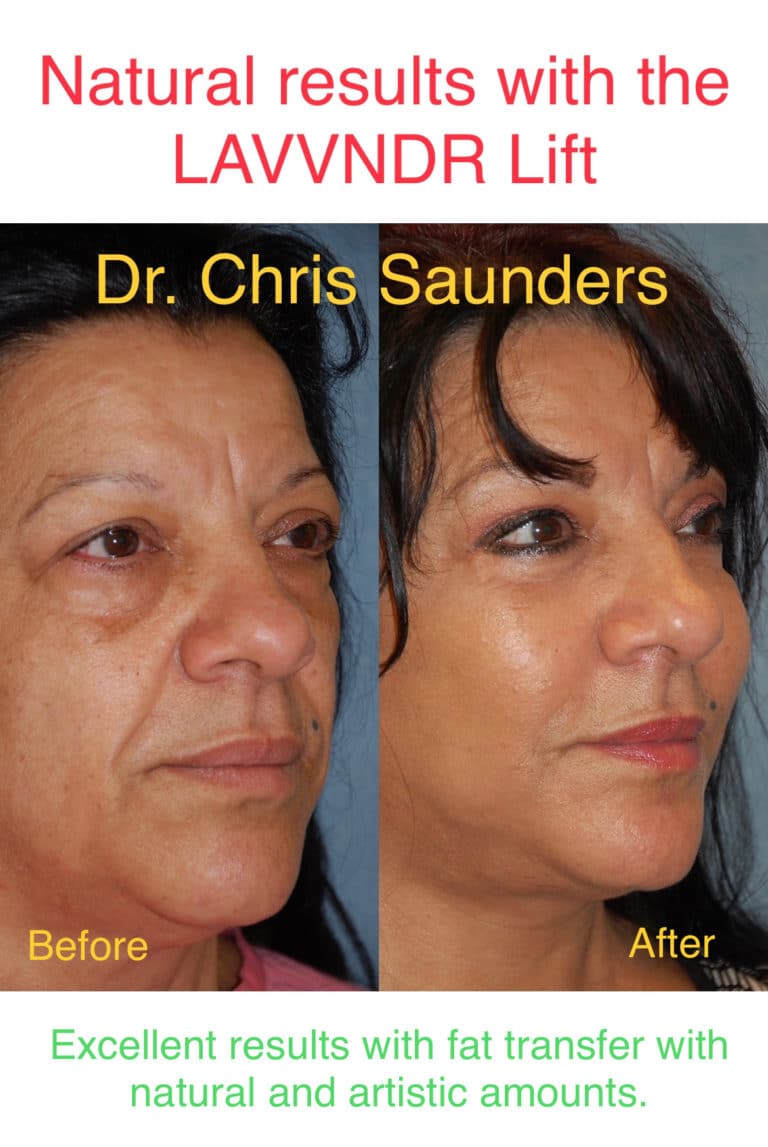 Fake, Weird, Bad, and Unnatural Results in Cosmetic and Plastic Surgery ...